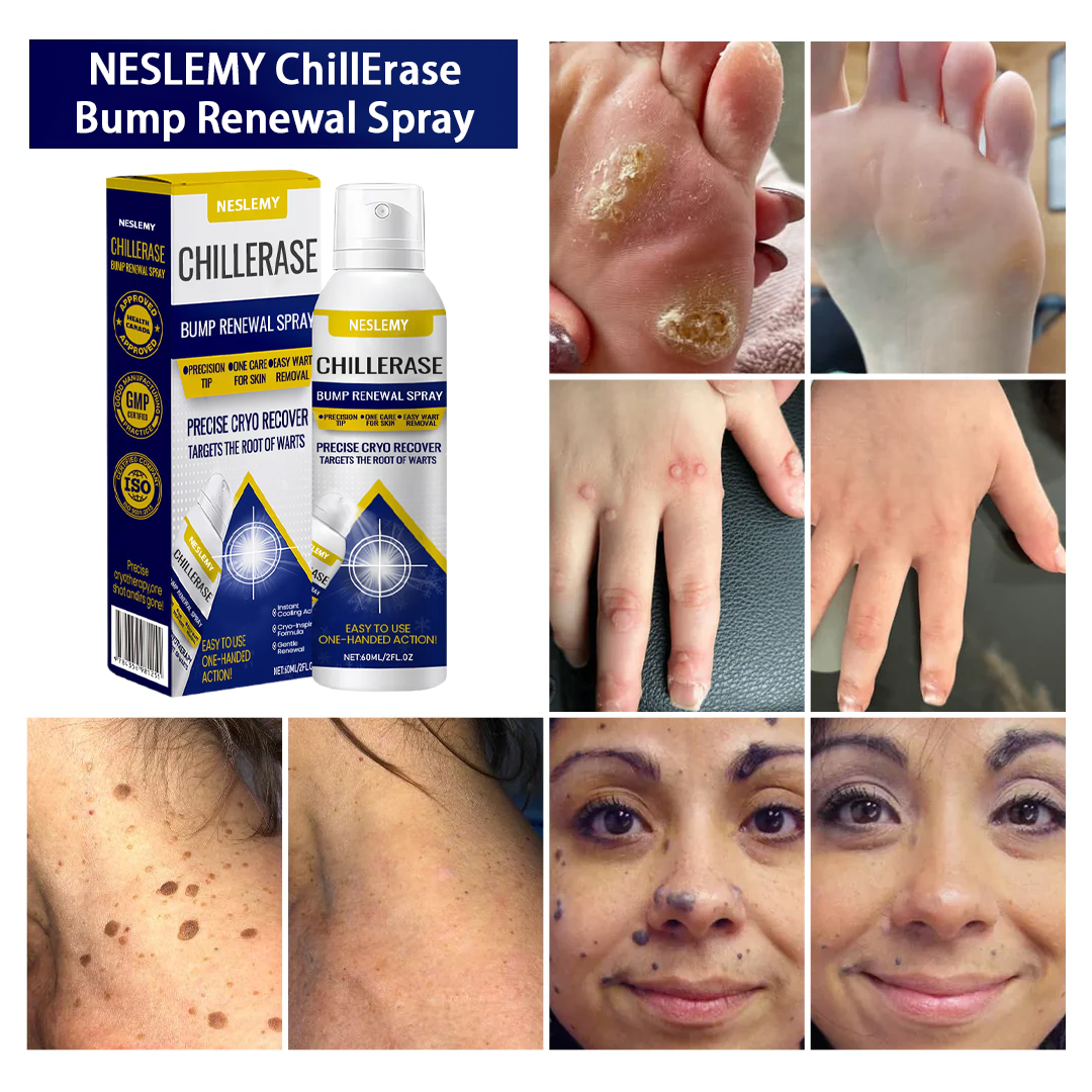 NESLEMY® ChillErase Bump Renewal Spray – Ambelago